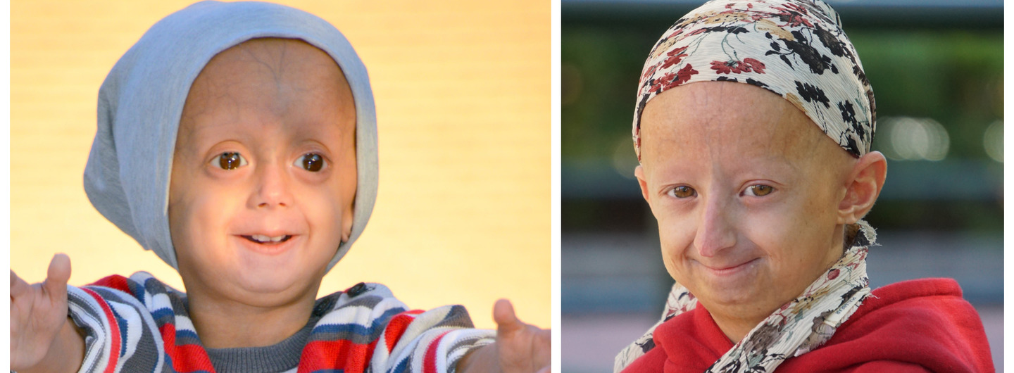 Tiltify - The Progeria Research Foundation